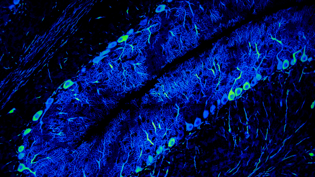 Image: Brain imaging | symmetry magazine